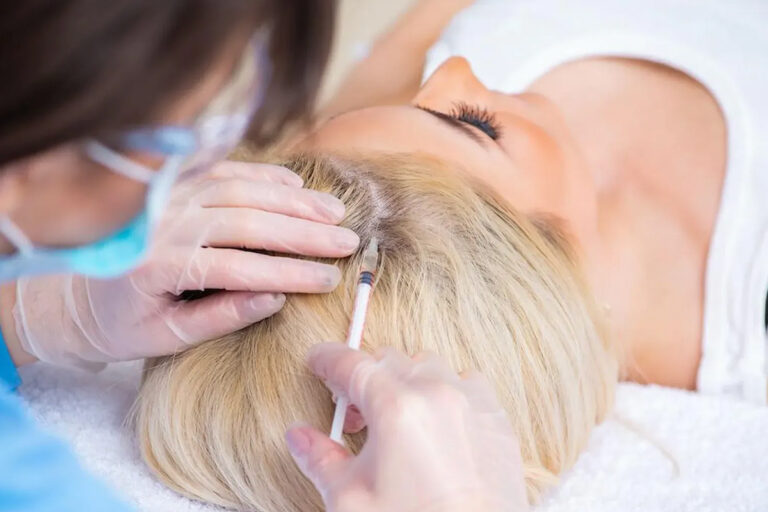 WHEN TO CONSIDER PLATELET-RICH PLASMA (PRP) THERAPY FOR HAIR LOSS ...