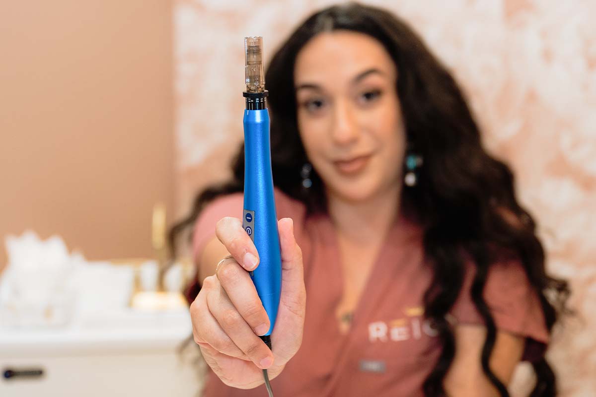 Microneedling in Clermont, FL | Reign Medical Aesthetics