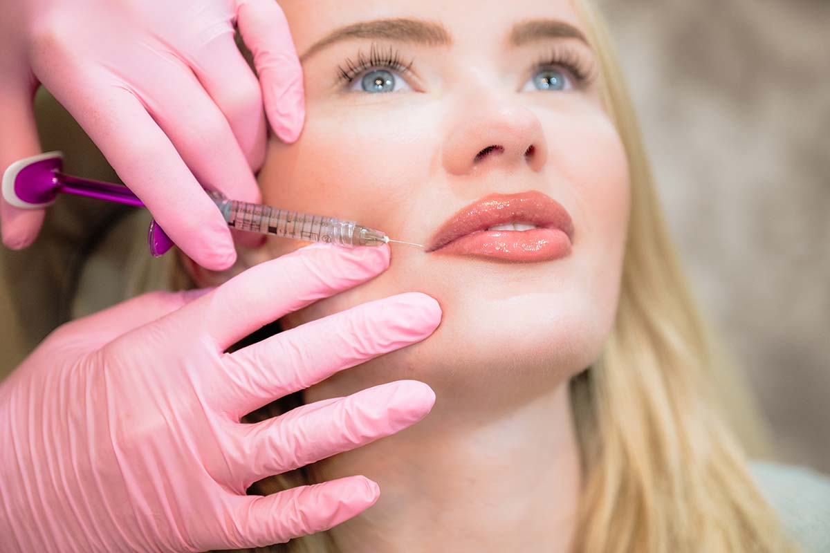 RHA Fillers in Clermont, FL | Reign Medical Aesthetics